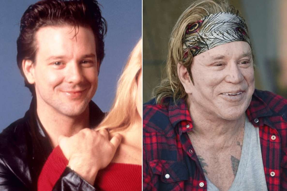 How Plastic Surgery Changed These Celebrities - World News - RadarMedia